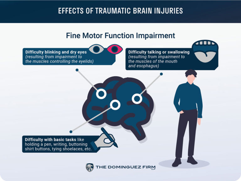 Los Angeles Traumatic Brain Injury Lawyer | TBI Attorney